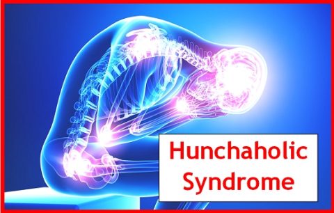 Trigger Point Therapy Solutions to Postural Dysfunctions 16 CEU NCBTMB Approved Live Workshop ...